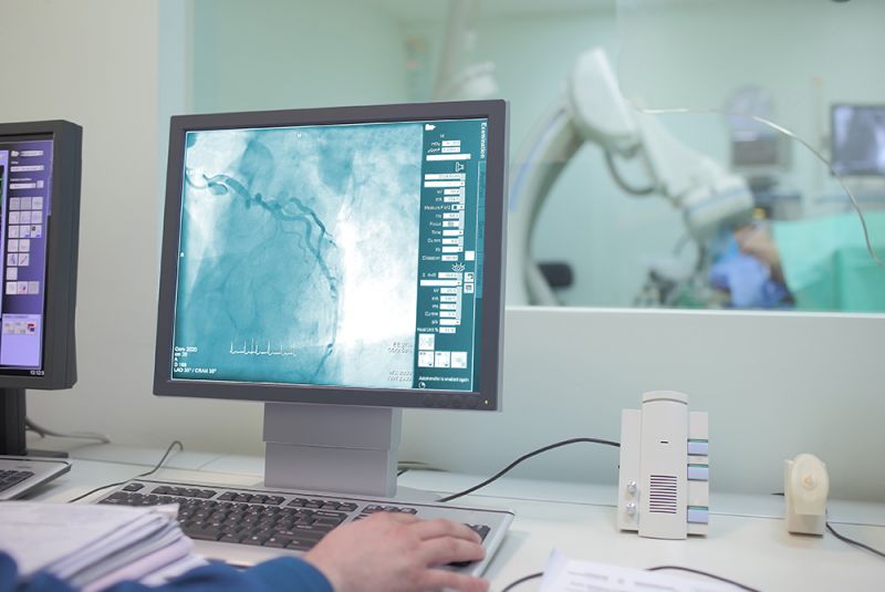 CTCA (CT coronary Angiogram) – Cardiac Testing